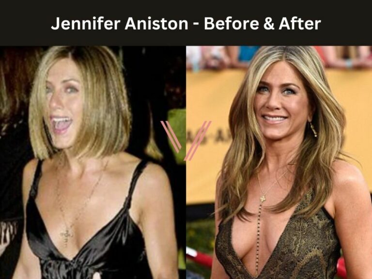Celebrities with Breast Implants | Before & After Photos